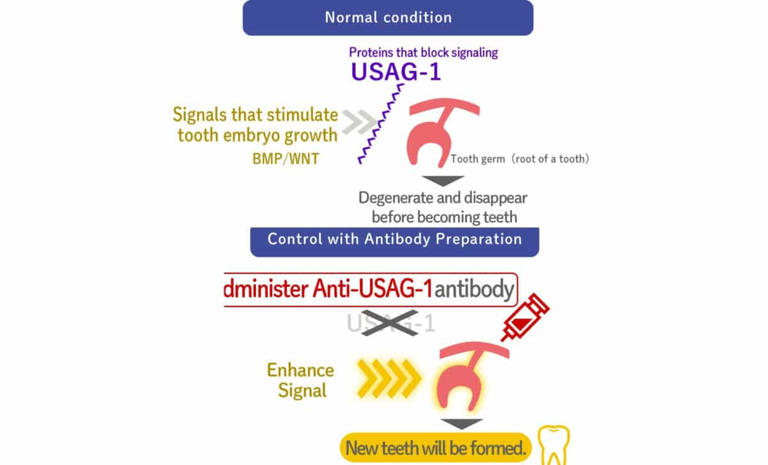 Humans may soon grow a third set of teeth, and Japan has already ...