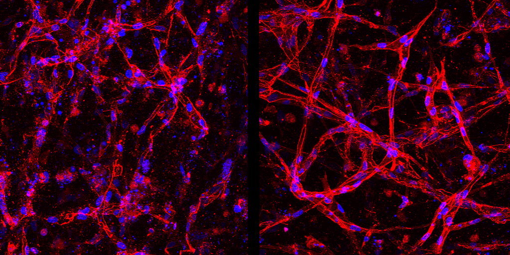 Stem cell breakthrough offers fresh hope for treating blindness