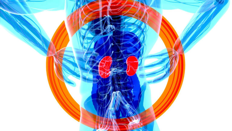 A cluster of heart, kidney and metabolic problems may quietly raise ...