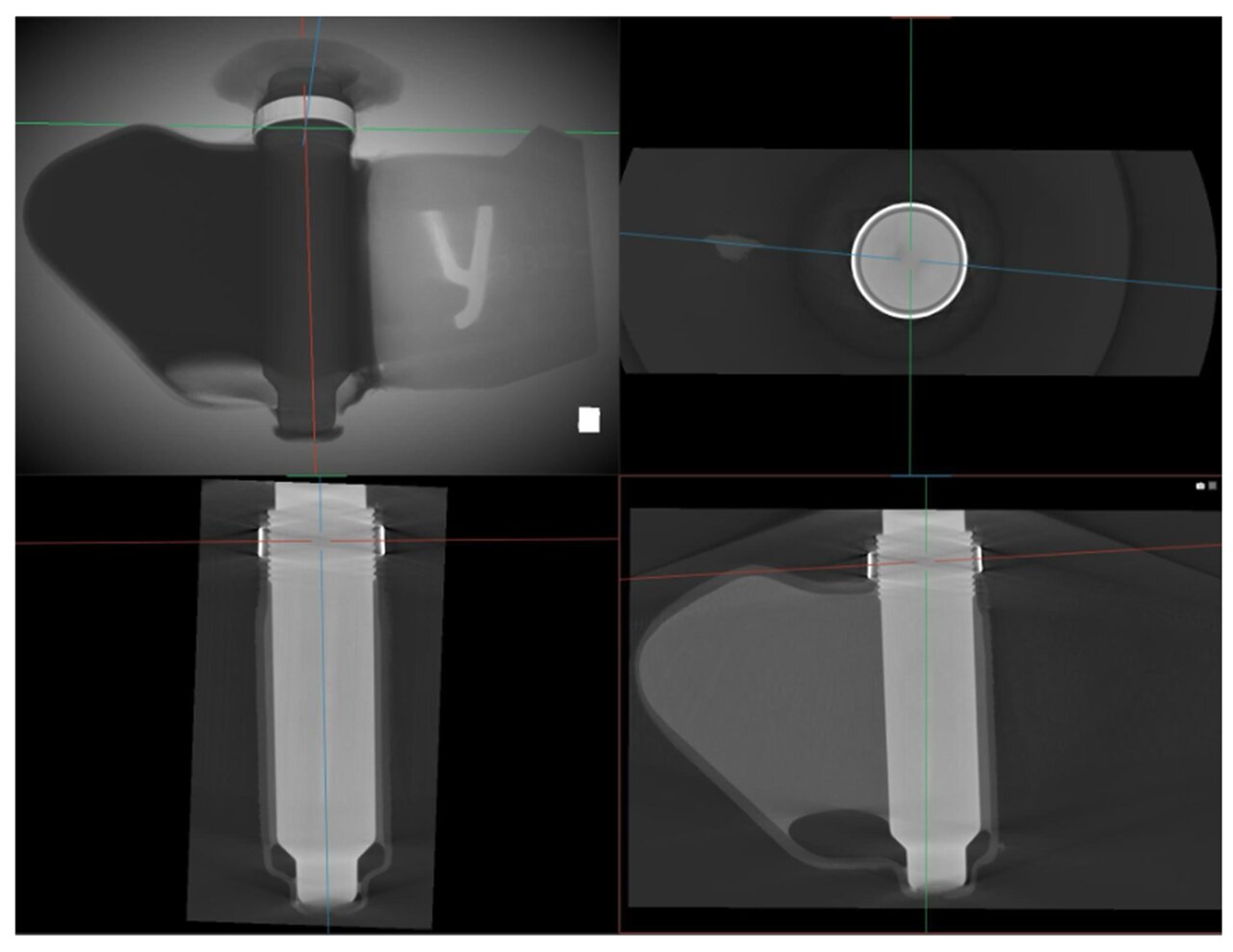 Drone-mounted camera can detect plastic landmines without an internet ...