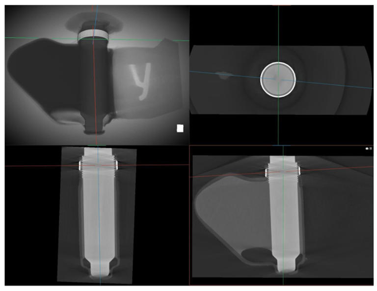 Drone-mounted camera can detect plastic landmines without an internet ...