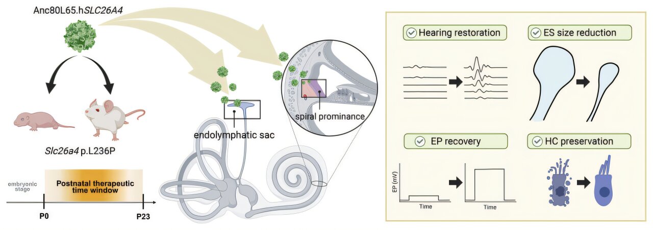 New postnatal gene therapy offers hope for congenital hearing loss