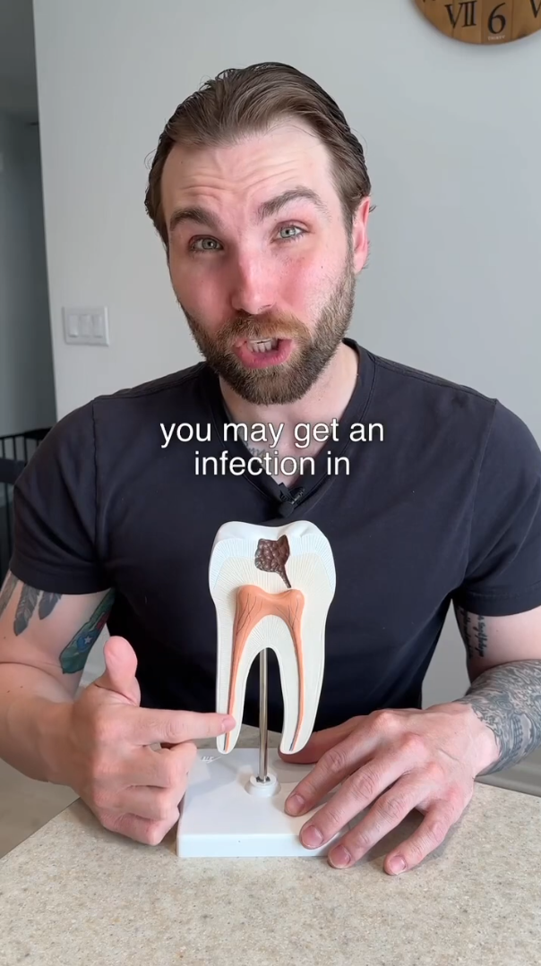 How a cavity forms inside your tooth explained simply