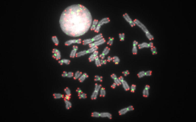 Loss of DNA protector gene exposes vulnerabilities in cancerous cells