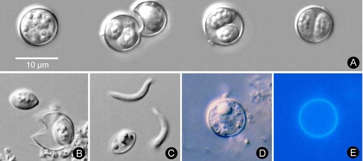 170 cases of cyclosporiasis, illness that causes 'explosive' diarrhea ...