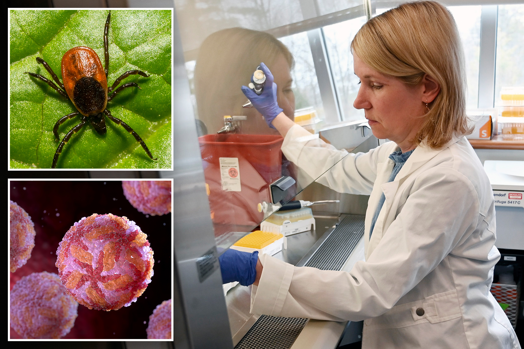Rare tick-borne virus turns deadly fast as US cases reach record high ...
