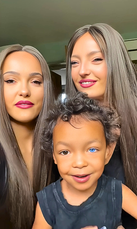 People say I fake my son’s eyes