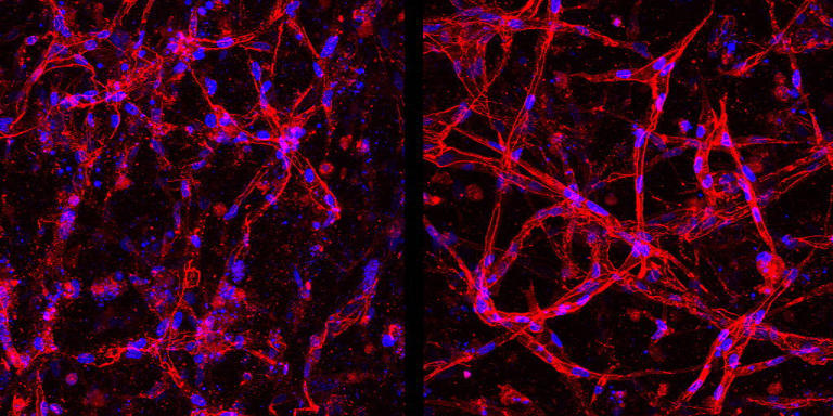Lab-grown cells restore vision in blind mice in breakthrough study