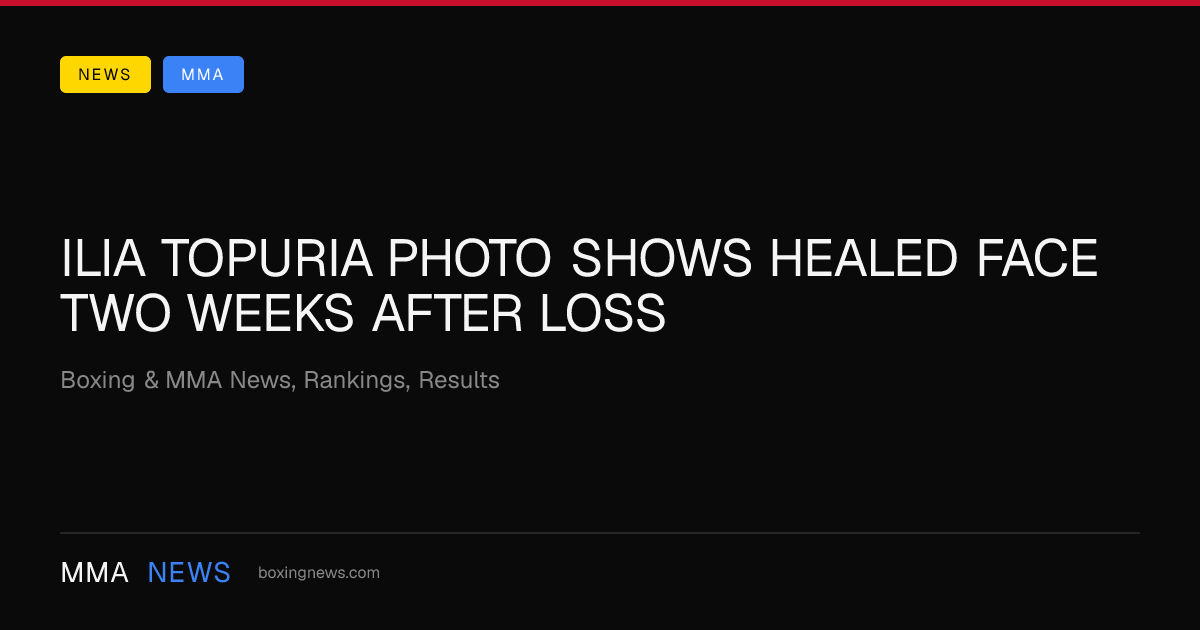Ilia Topuria photo shows healed face two weeks after loss