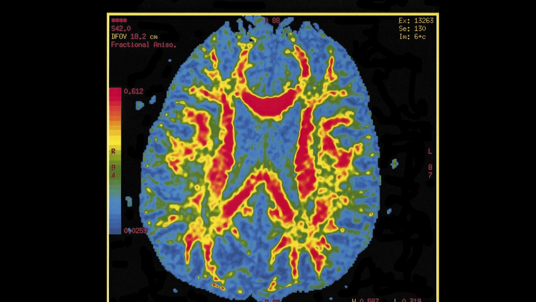 How the brain creates the sense of self