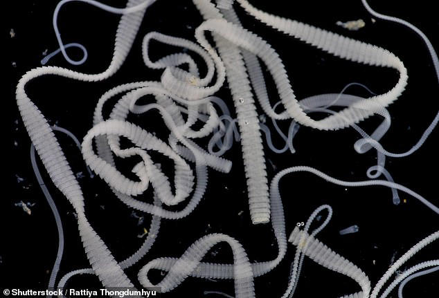 Parasite horror: I had a metre long tapeworm in my gut and 38 more in ...
