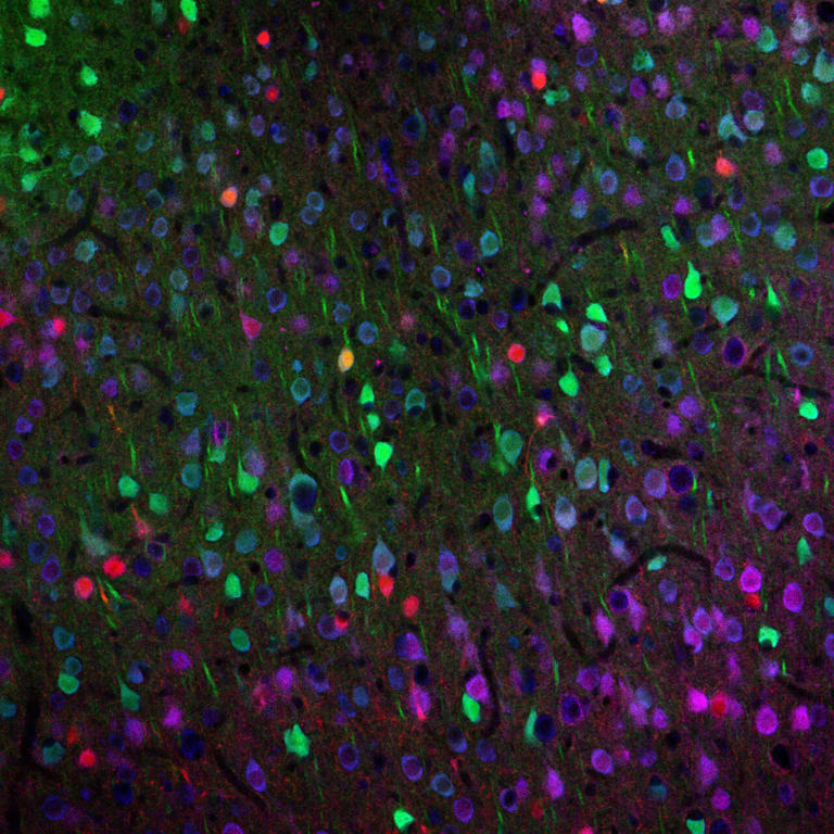 Neurobiologists improve symptoms of Huntington's disease with targeted ...