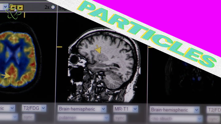 Brain shrinkage linked to COVID-19