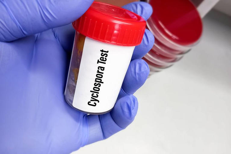 Parasite causing explosive diarrhea spreading unchecked across US