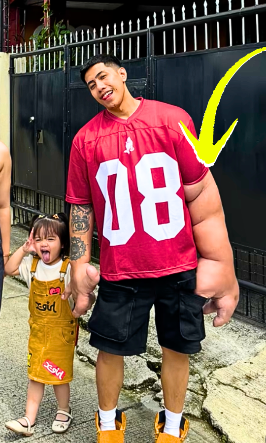 TikToker explains genetic condition 🚨