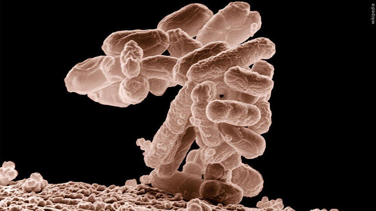 High E coli levels found at Riverview Park sandbar in North Augusta