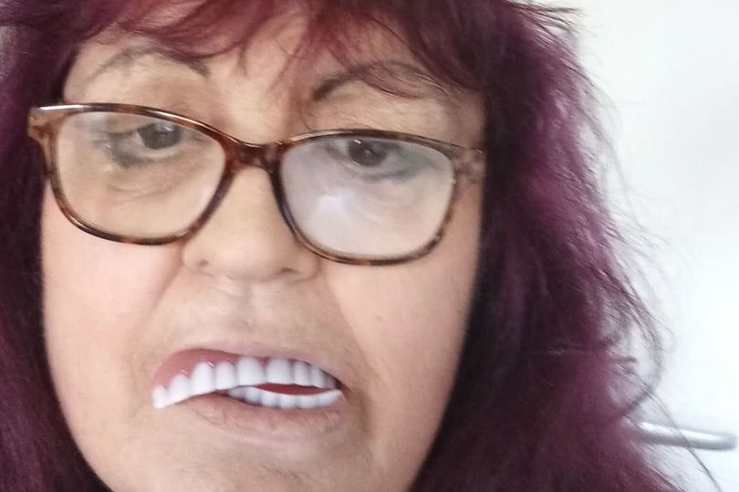 Mum buys £14.99 fake teeth on Facebook to fix her smile and it all goes ...