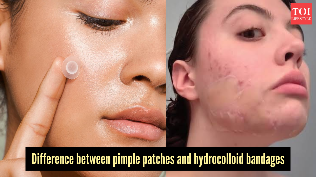 Pimple patches vs hydrocolloid bandages: Which acne treatment works best?