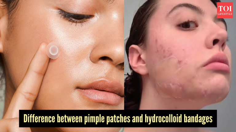 Pimple patches vs hydrocolloid bandages: Which acne treatment works best?