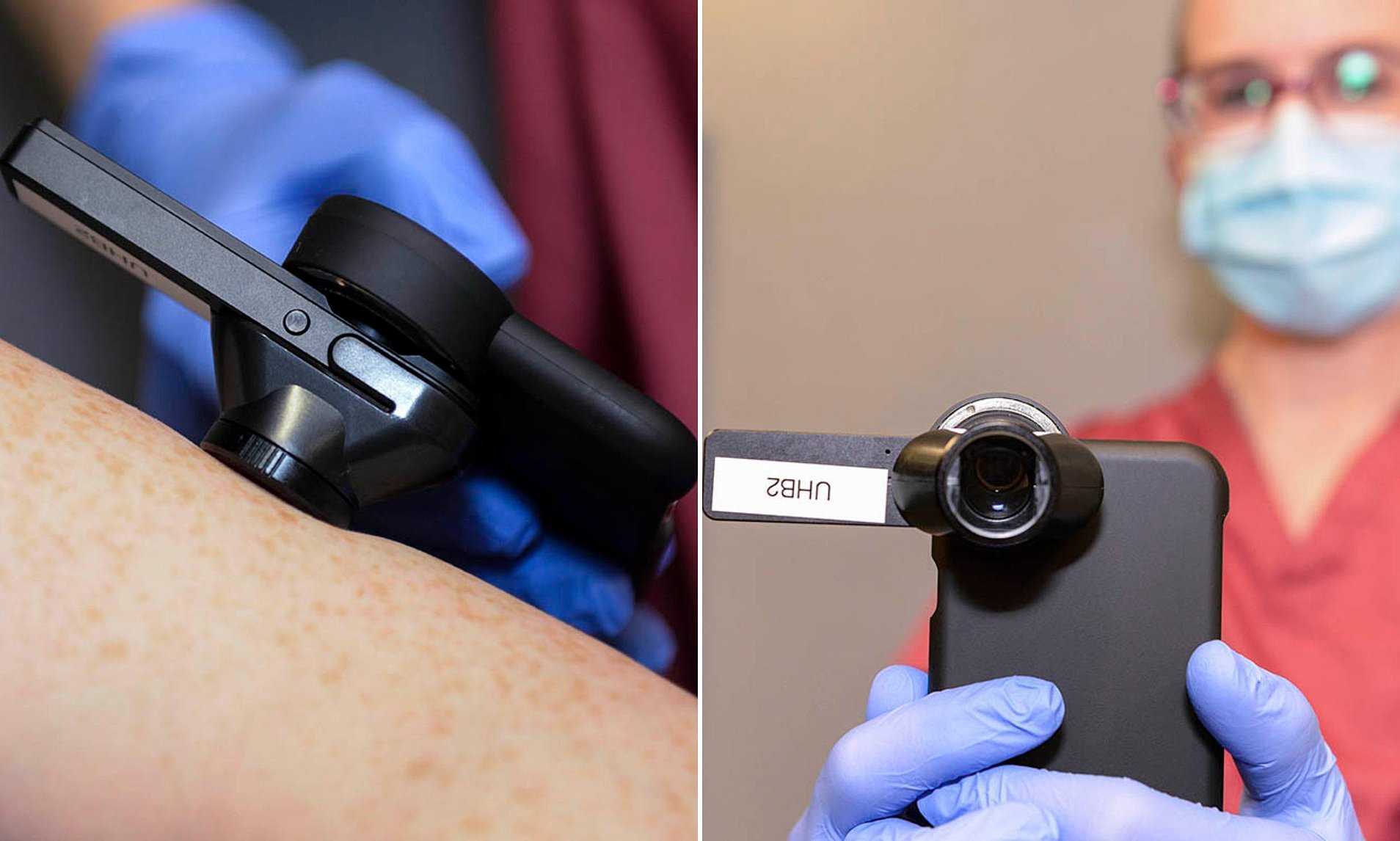 Revolutionary new AI smartphone app can spot deadly skin cancers