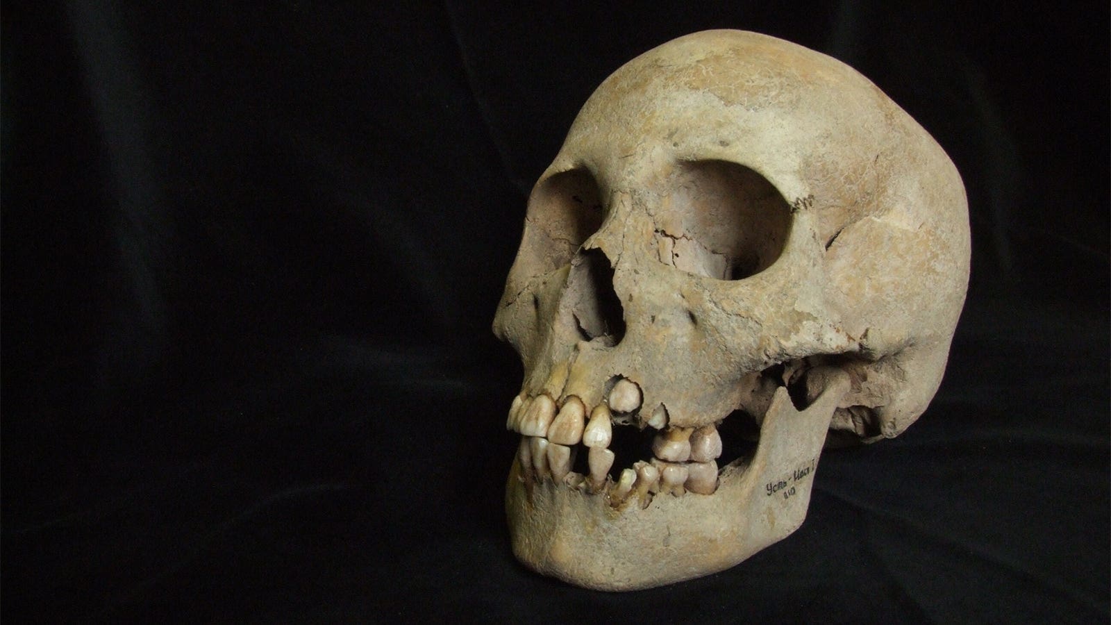 Ancient teeth push the plague's timeline back to over 5,500 years ago