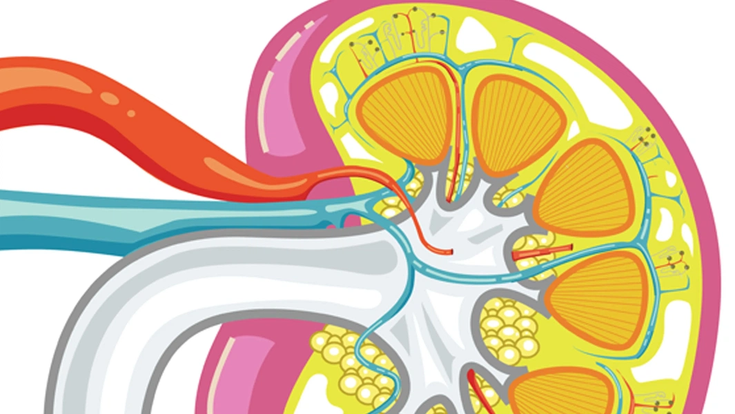 Kidney health risks in deep space travel