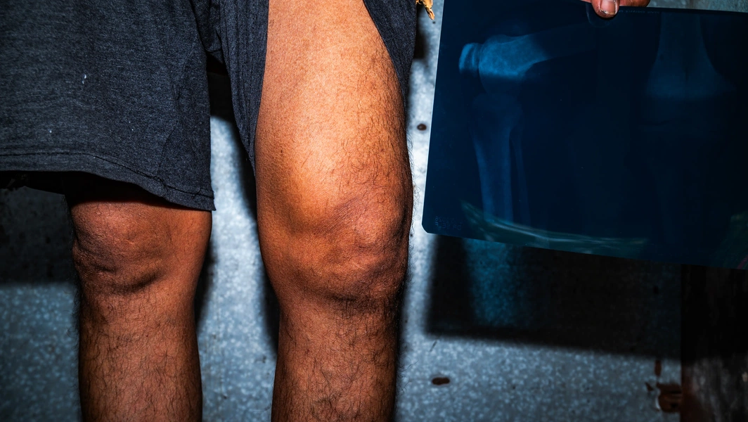 Recognizing and addressing chronic inflammation