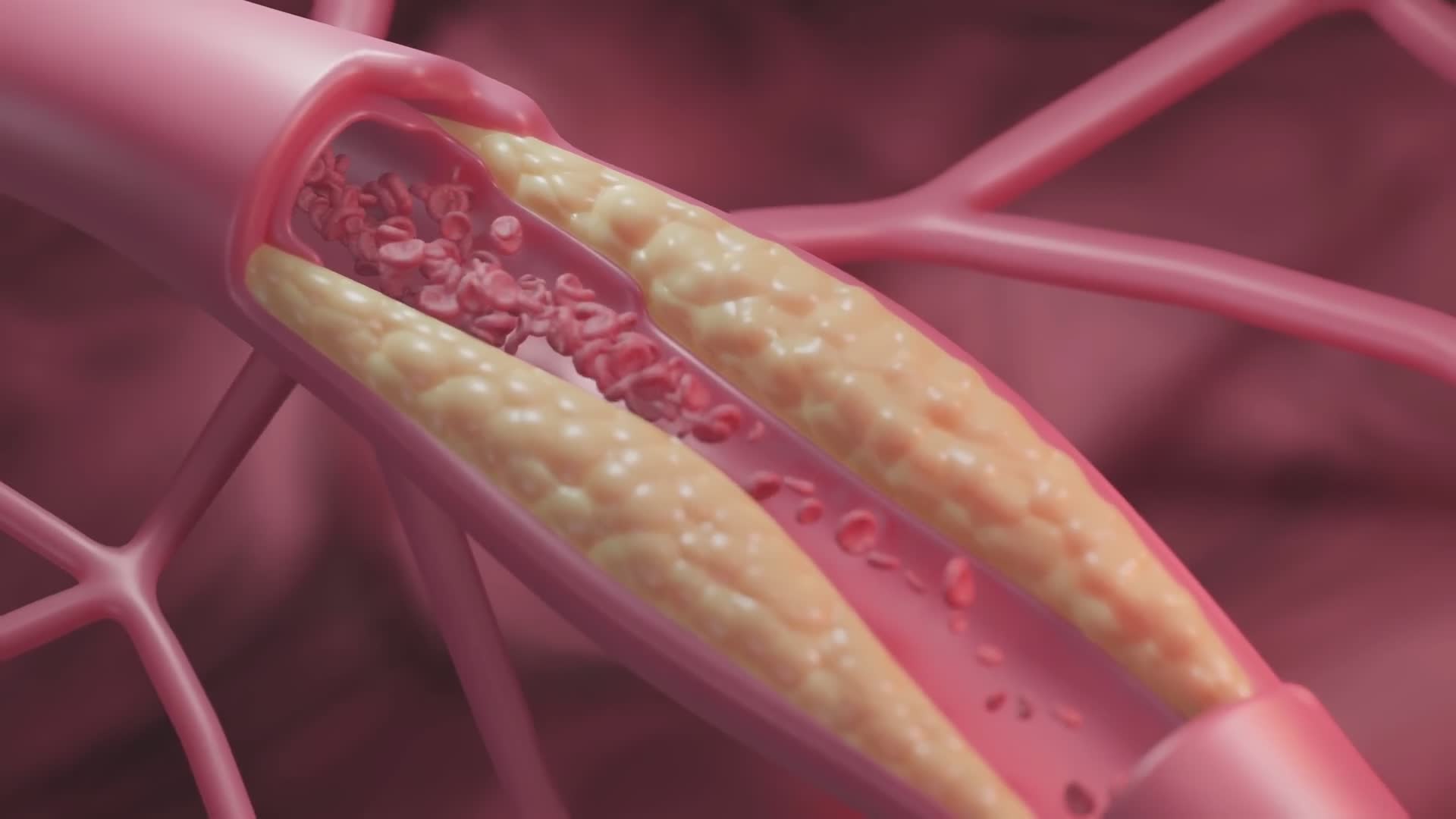 Cardiologists explain how to manage dangerous cholesterol marker the ...
