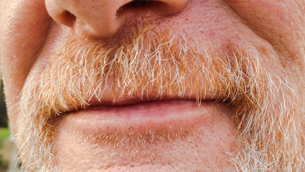 Factors influencing mustache growth