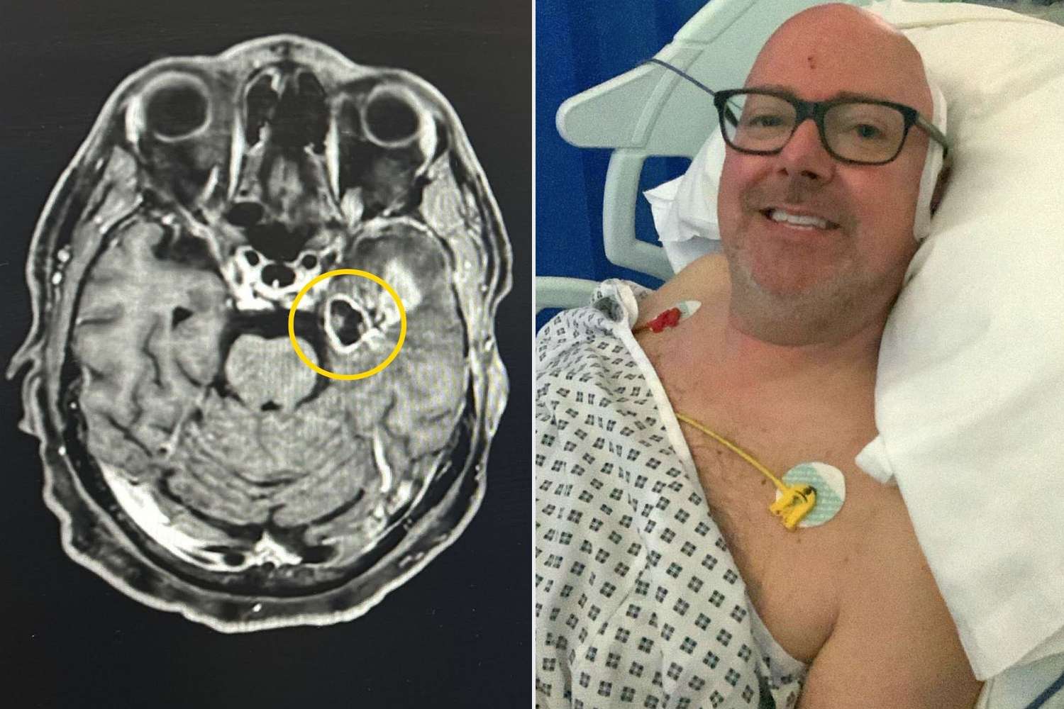 Dad of 2 thought dizziness was caused by quitting drinking alcohol. It ...