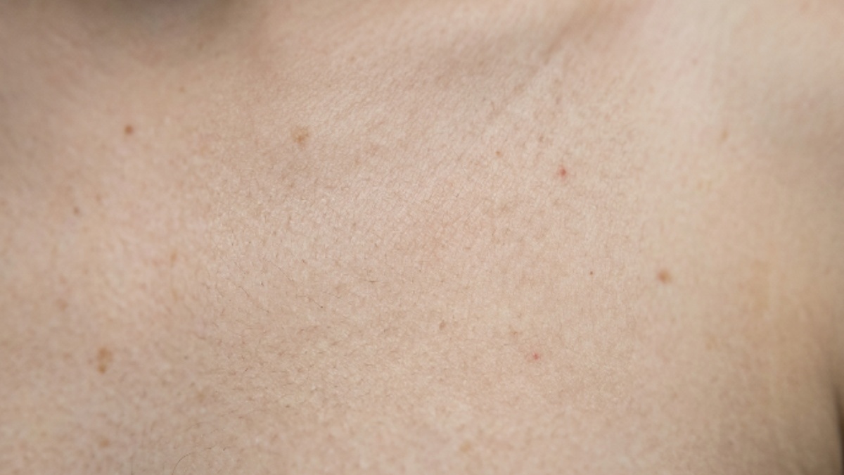 7 early warning signs of breast cancer experts want you to know