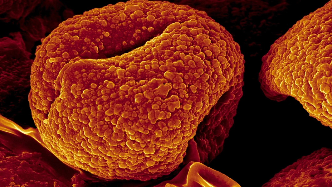 5 Pennsylvania cities with high pollen rankings