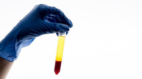 65-year-old man sees unusual urine colour change; Mumbai doctor warns ...