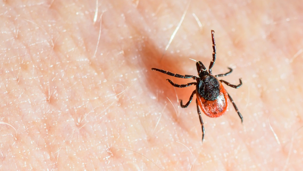 Safe tick removal and prevention tips