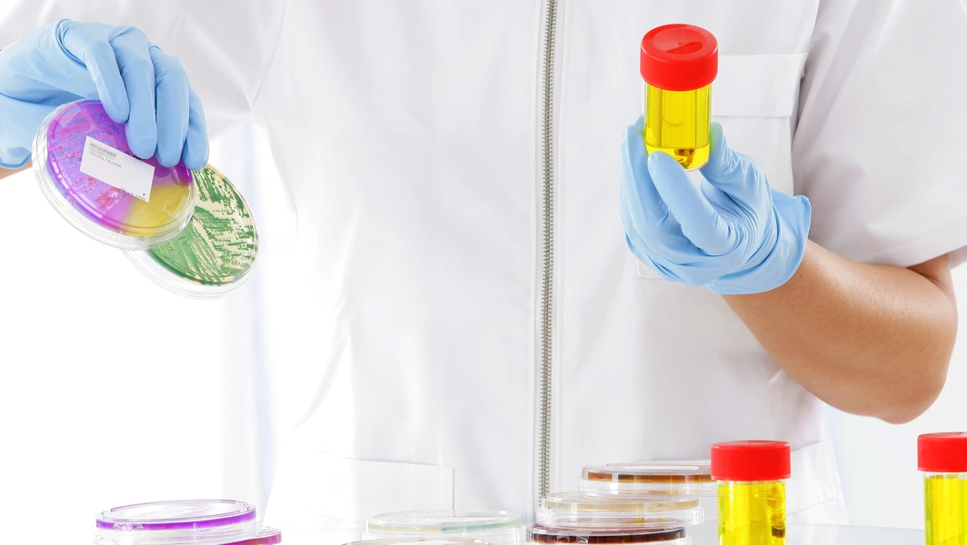 Recognizing early signs of bladder cancer