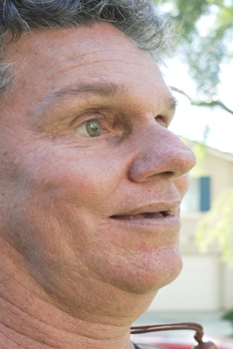 Seeing the world through echolocation