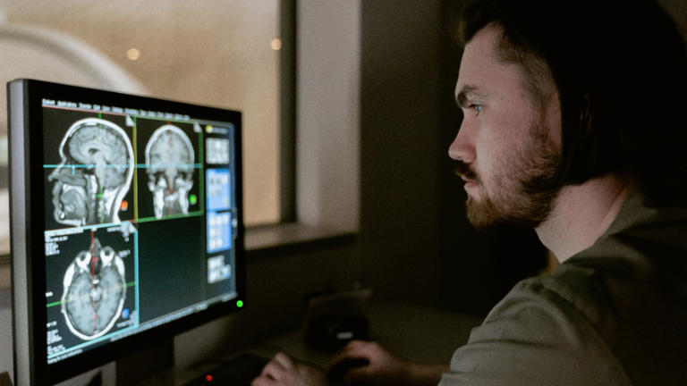 Brain microplastic levels run highest in tumor-affected tissue