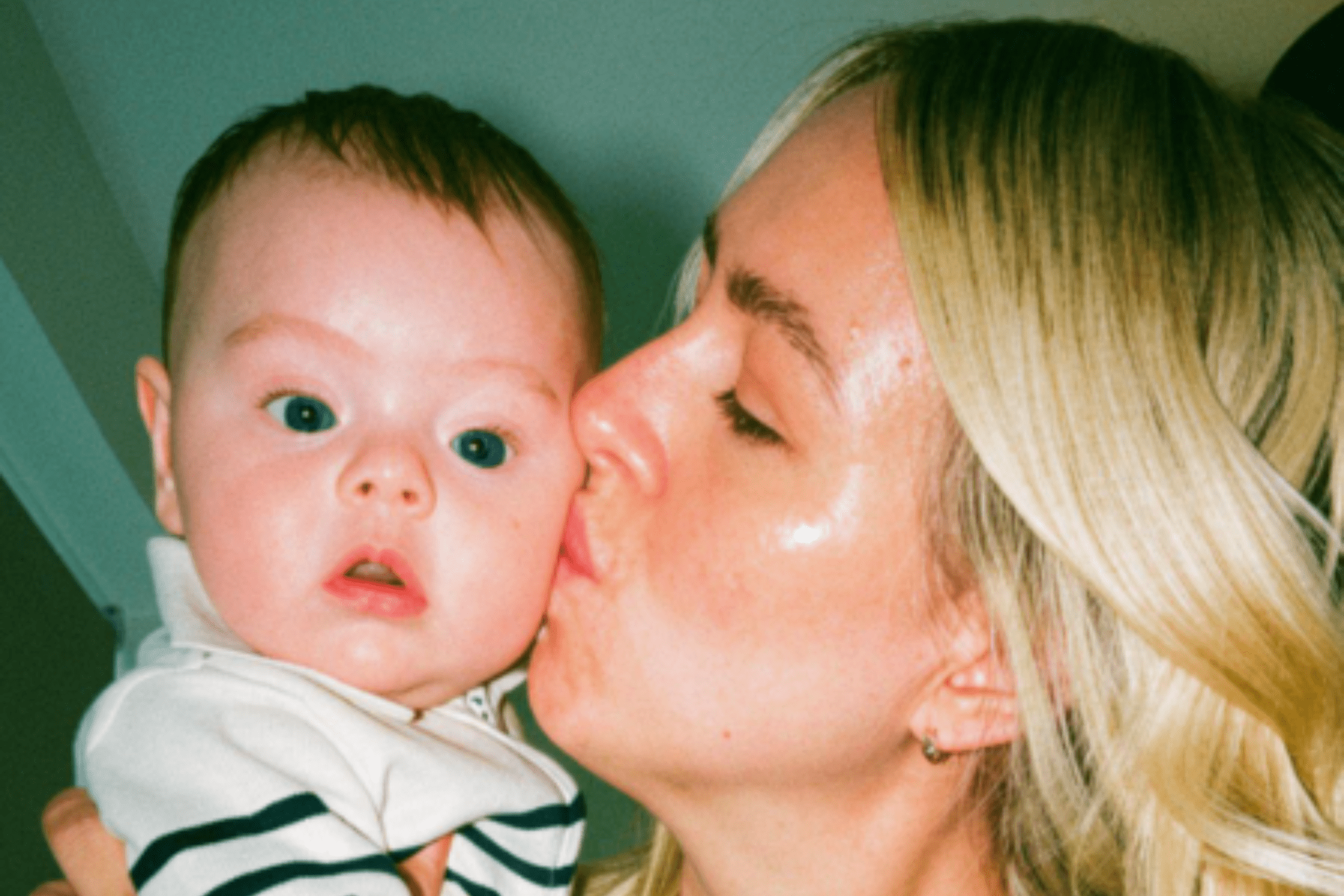 Woman feared baby would be scared of her after brain tumor—she was so wrong