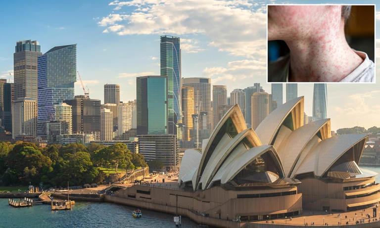 International traveller sparks urgent public health warning for ...