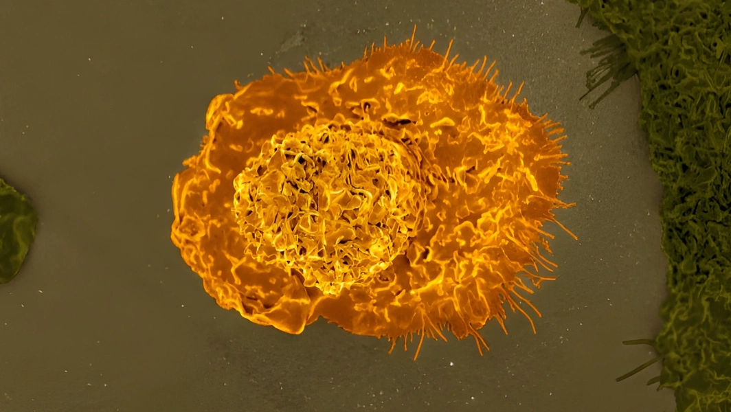 Mechanisms and modifiers of inflammaging