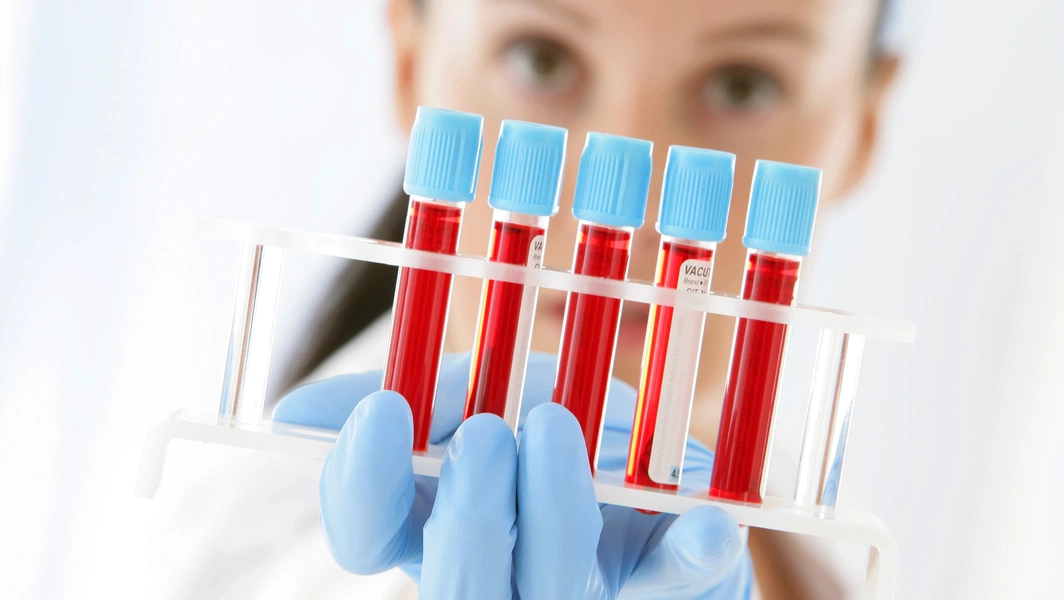 Blood biomarkers for early dementia detection