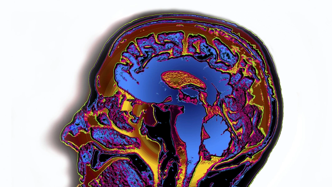 Vitamin C’s role in aging brain health