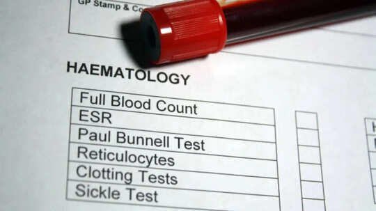 A simple blood test before marriage could save your child from a ...