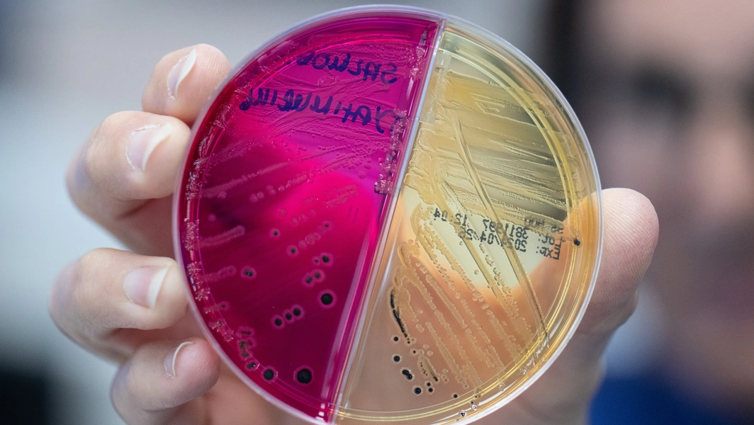 Gut and blood biomarkers for early dementia detection