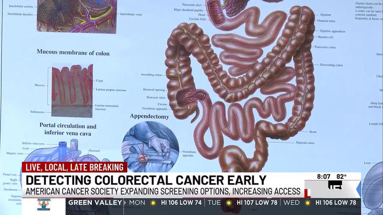 Colorectal cancer screening guidelines expand testing options. Here’s how.