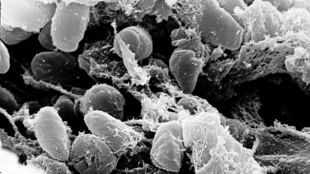 Ancient plague outbreaks in prehistoric Siberia