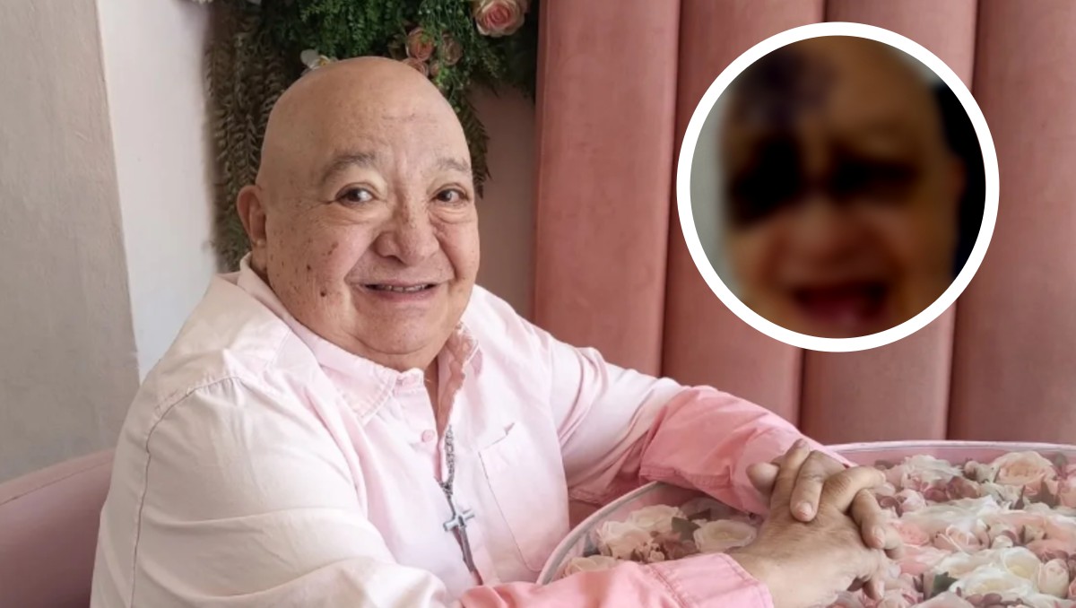 ¿Qué le pasó a Luis de Alba? Esposa del actor comparte detalles sobre ...