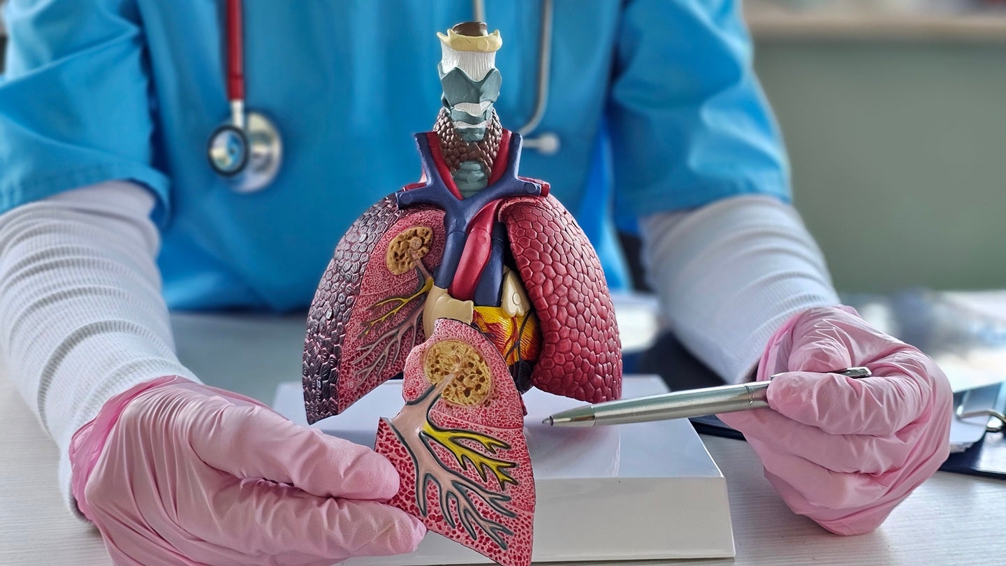 Kither Biotech concludes phase I study of KIT2014