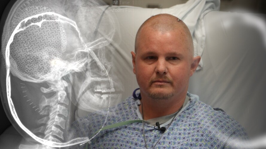 FL brain tumor patient denied insurance coverage for surgery gets full ...