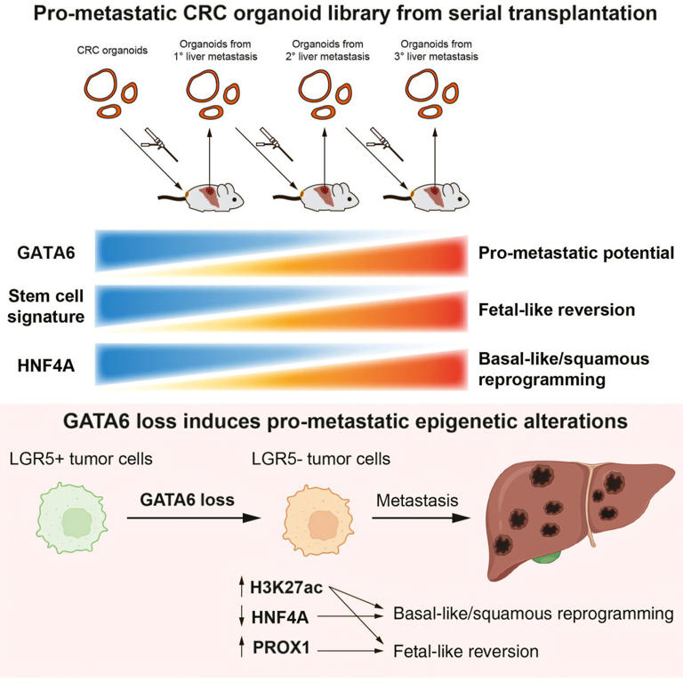 Colon cancer cells may change identity to metastasize